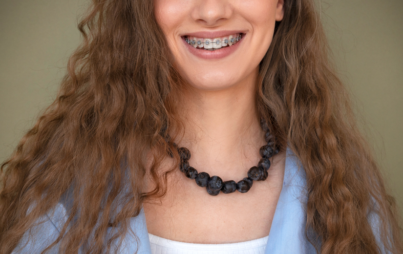 Mordida Cruzada: Consecuencias, Tipos y Tratamientos | Dental Company